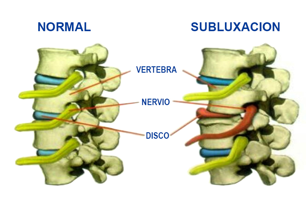 QUIROPRAXIA - LIC. DIEGO S. RODE